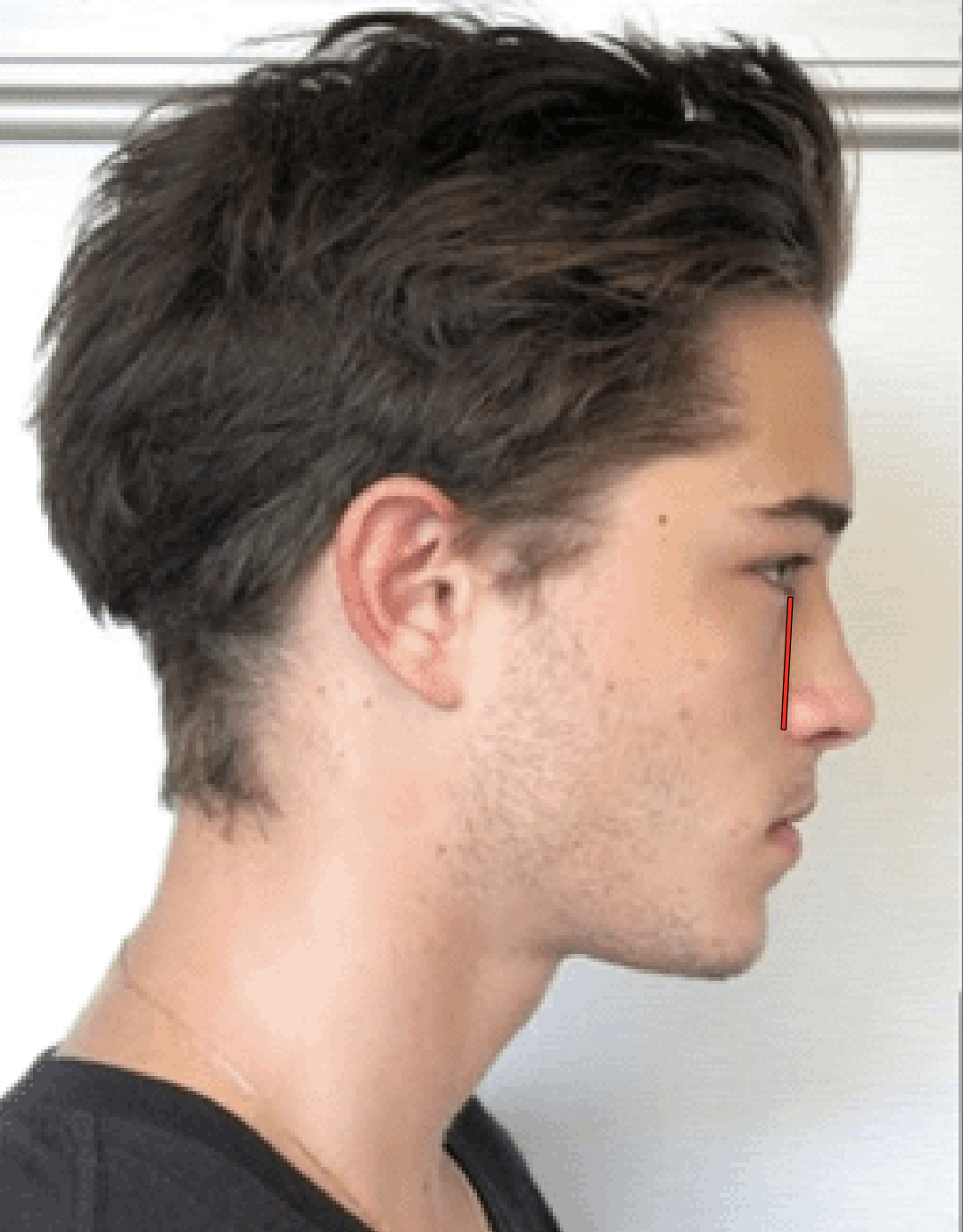 does this considered forwardly grown maxilla? | Looksmax.org - Men's ...