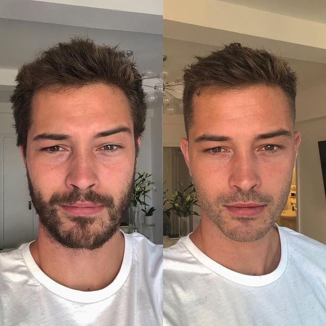 Rate Chico Before / After | Looksmax.org - Men's Self-Improvement ...