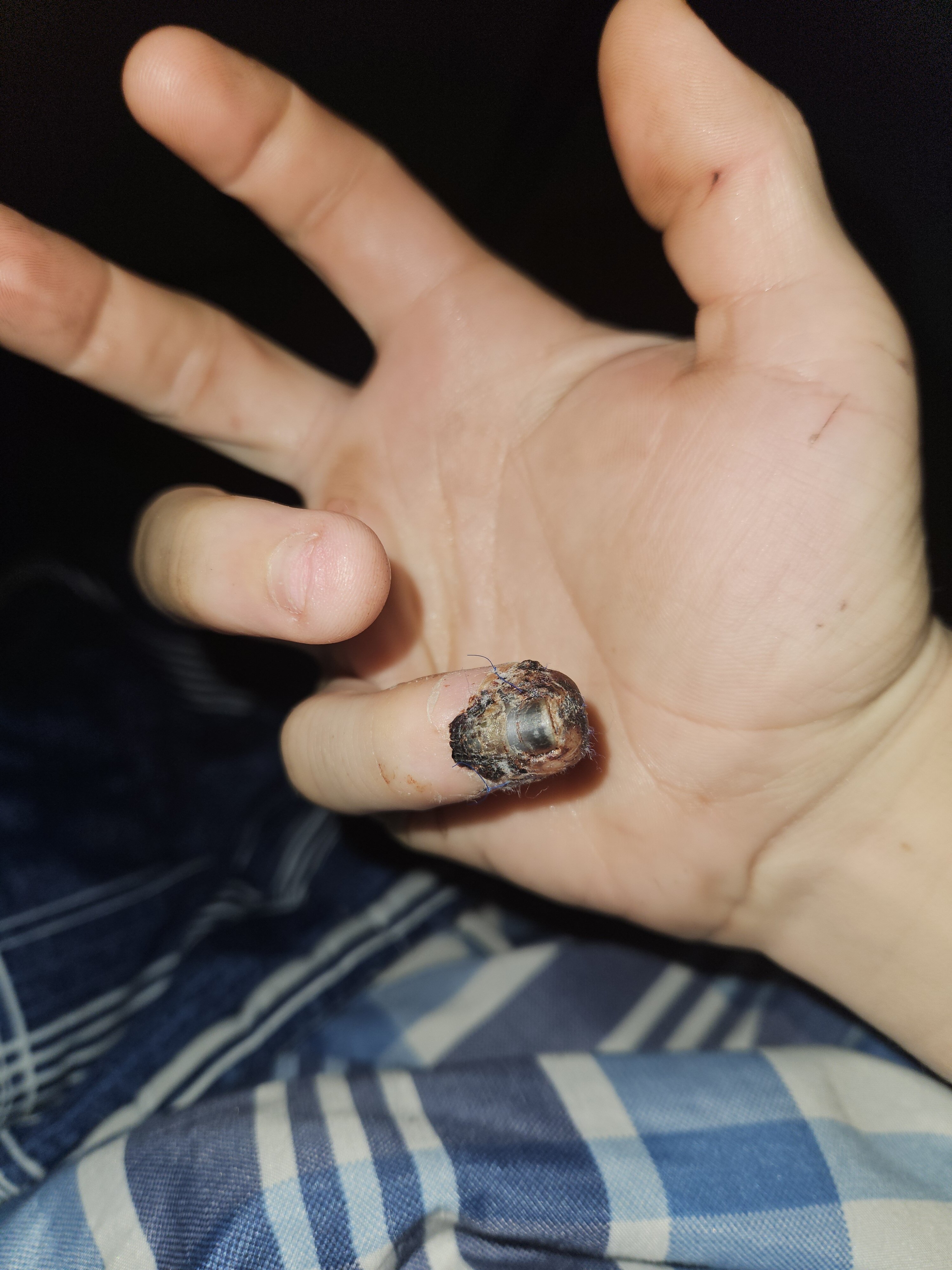 I cut my pinky fonger off | Looksmax - Men's Self-Improvement & Aesthetics