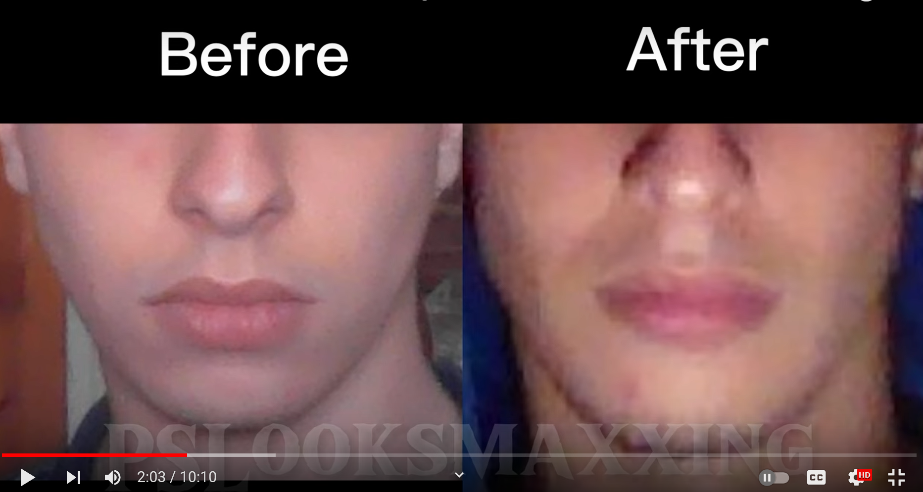 Mewing, chewing, neck training ascend him? | Looksmax - Men's Self ...