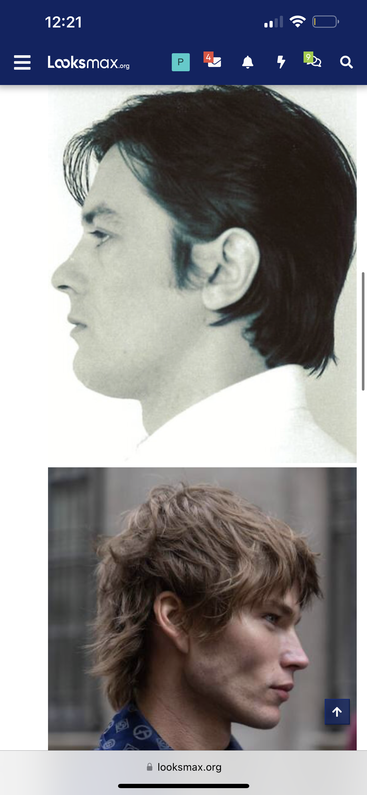 Zygoless normie vs giga chad | Looksmax.org - Men's Self-Improvement ...