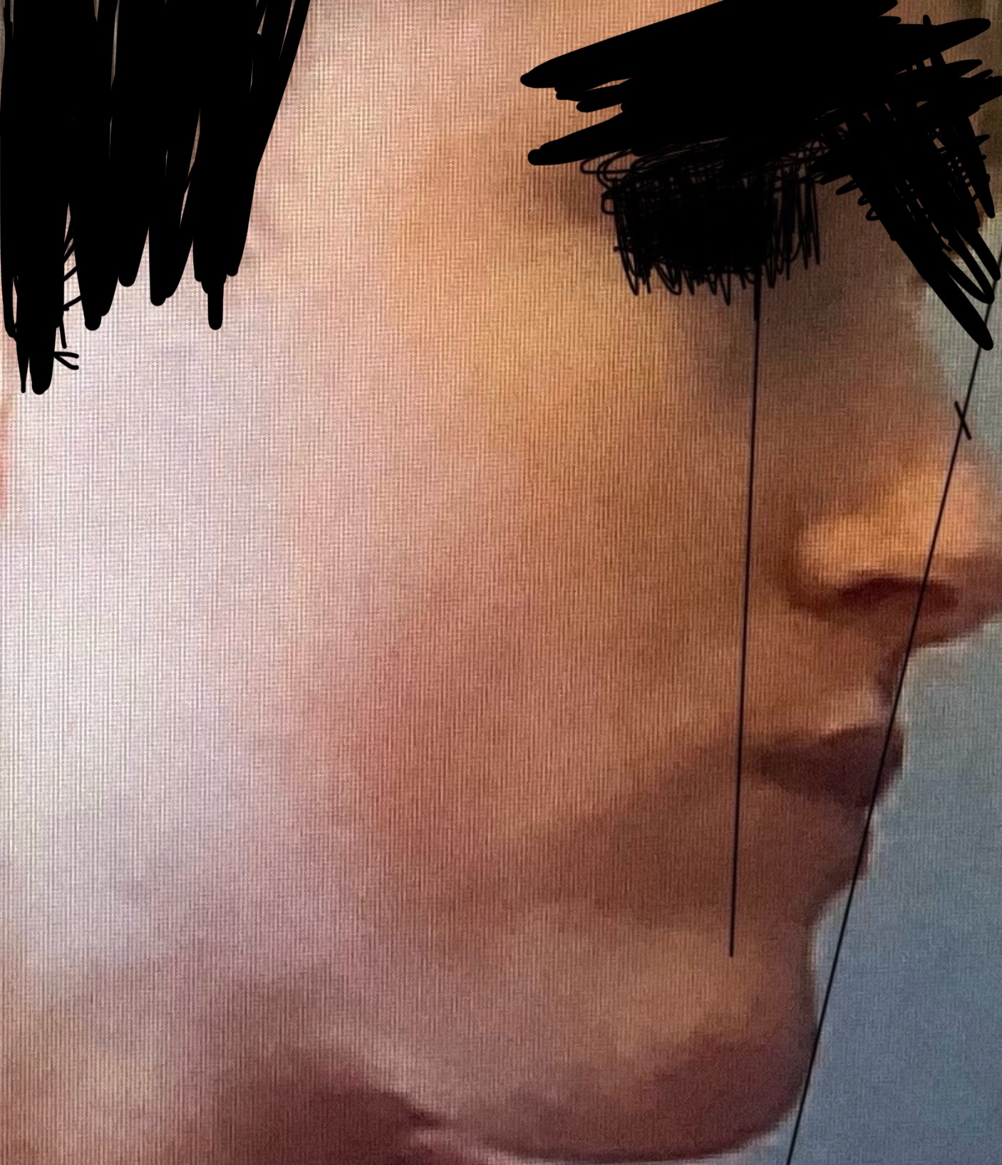 [HELP[PHOTOS]]Asymmetrical side profiles maxilla/facial growth. One ...