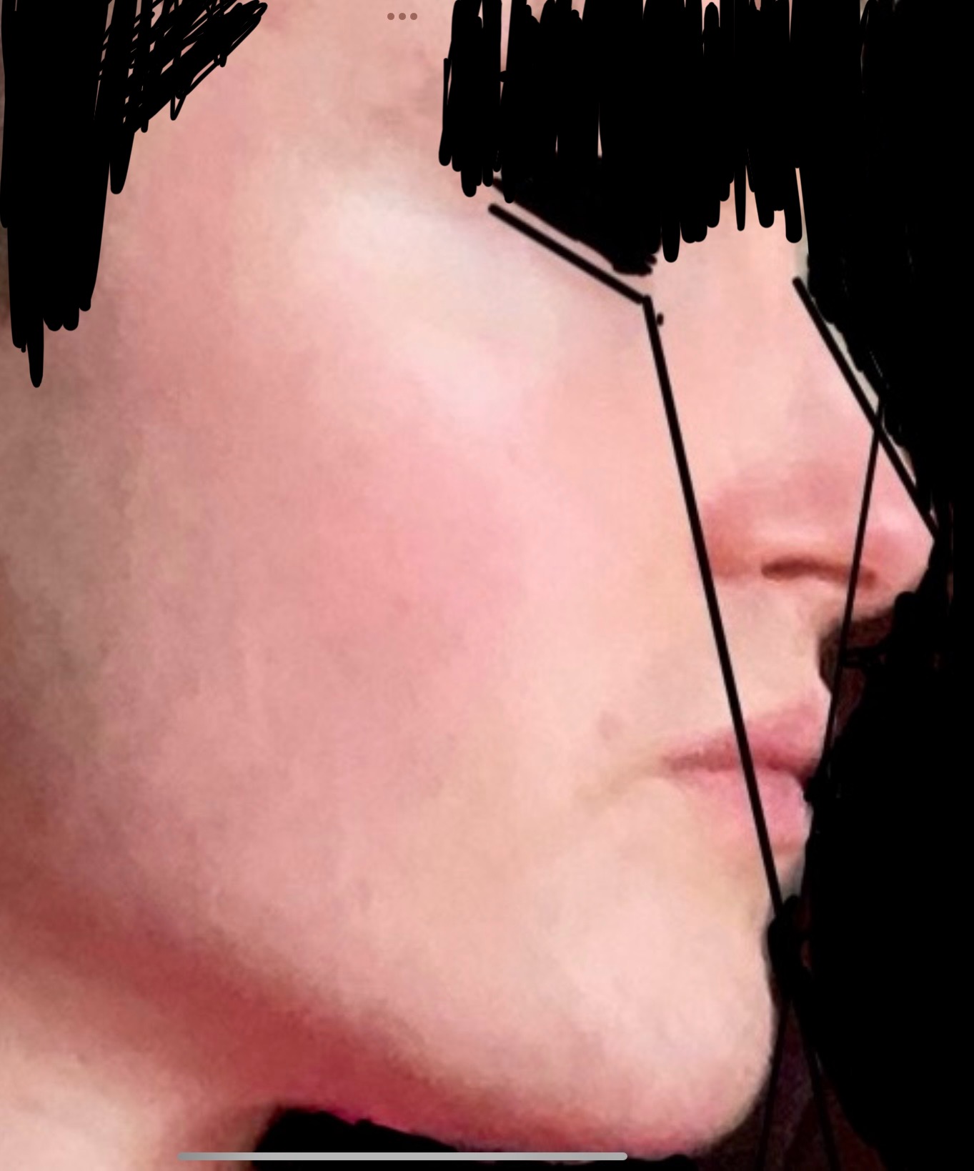 [HELP[PHOTOS]]Asymmetrical side profiles maxilla/facial growth. One ...