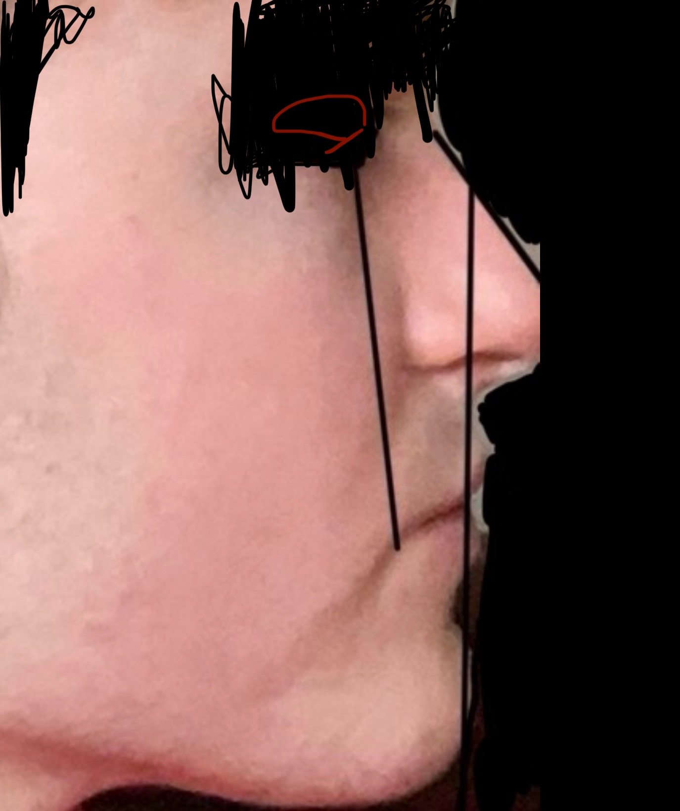 [HELP[PHOTOS]]Asymmetrical side profiles maxilla/facial growth. One ...