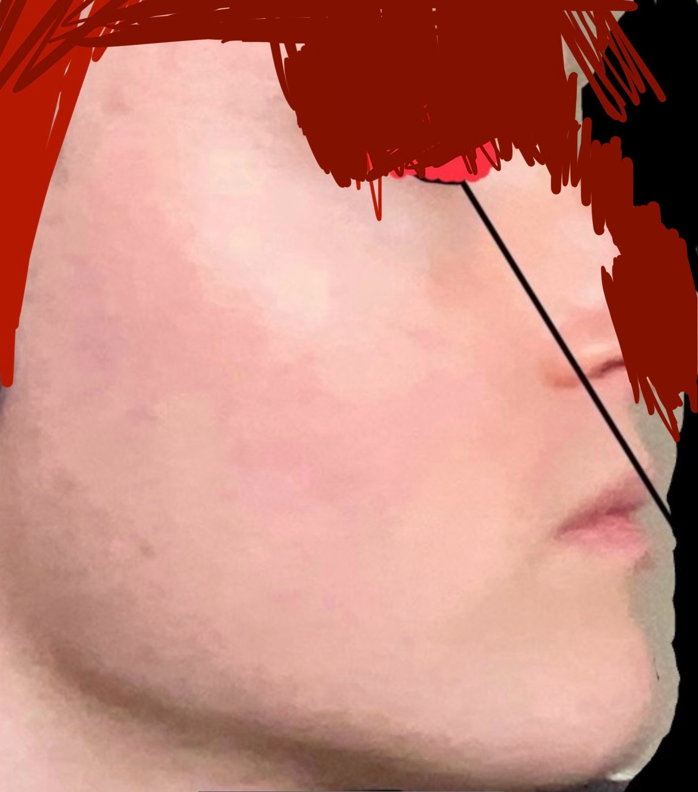 [HELP[PHOTOS]]Asymmetrical side profiles maxilla/facial growth. One ...