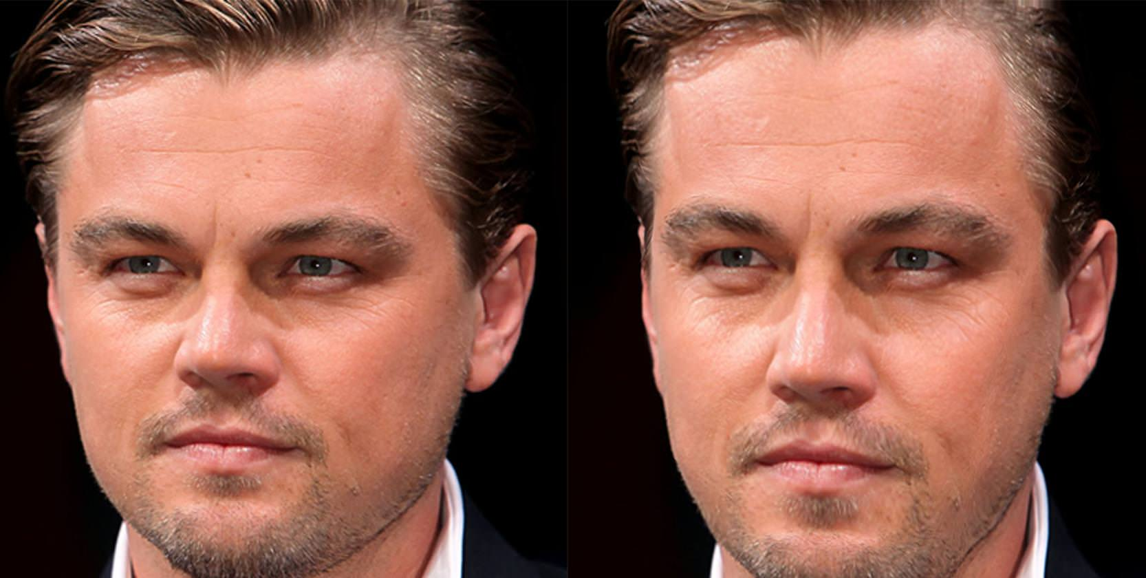 Compact Midface is cope | Looksmax.org - Men's Self-Improvement ...