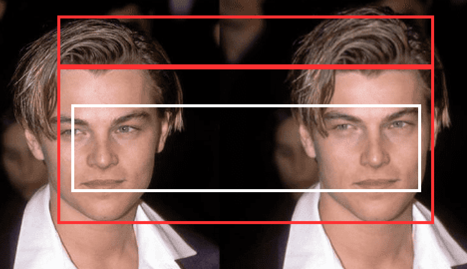 Compact Midface is cope | Looksmax.org - Men's Self-Improvement ...