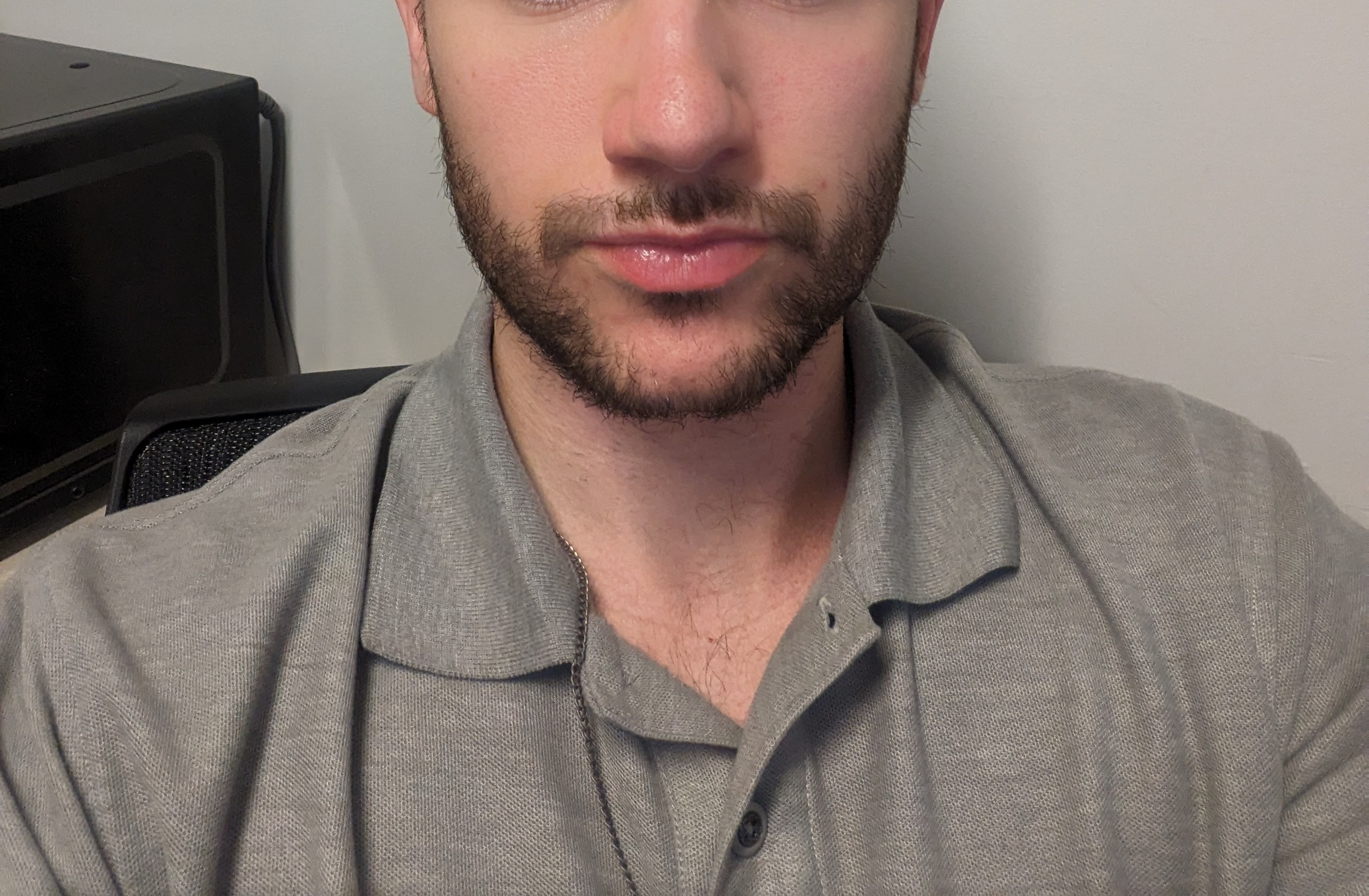 Would I benefit more from a rhinoplasty or a custom wrap around jaw ...