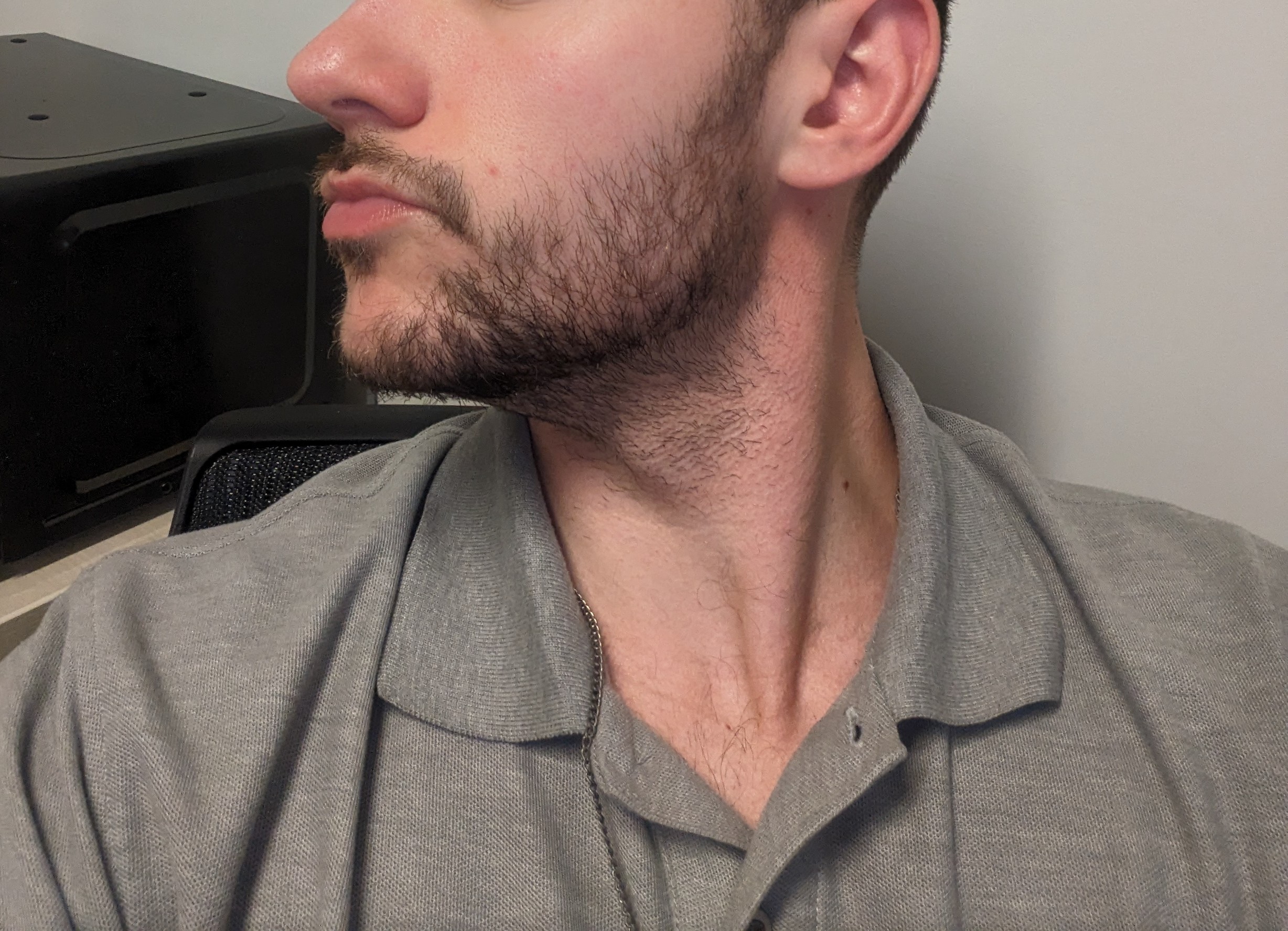 Would I benefit more from a rhinoplasty or a custom wrap around jaw ...