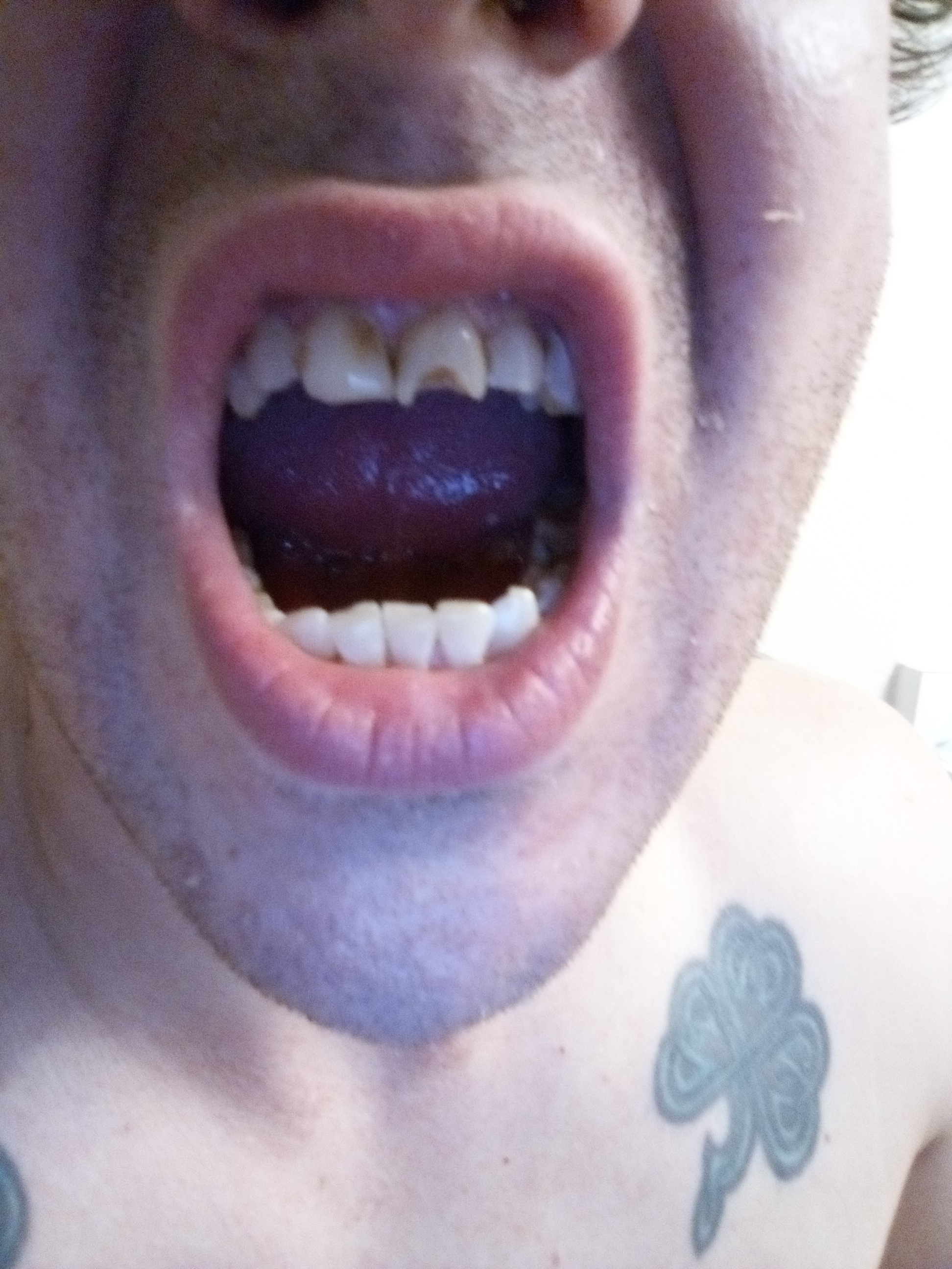 Why do japanese women have bad teeth? | Looksmax.org - Men's Self ...
