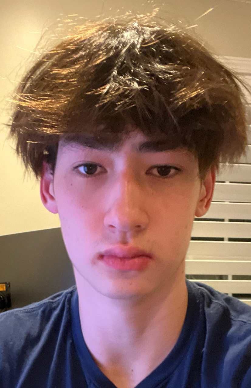 I've never seen anyone with a narrow face and long midface that aren't ...