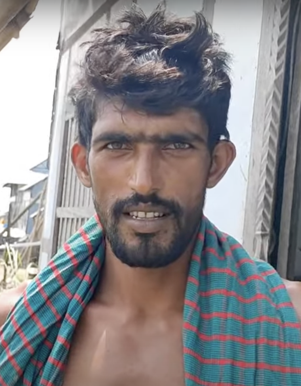You wake up with pajeet eye area/orbitals, what would you do ...