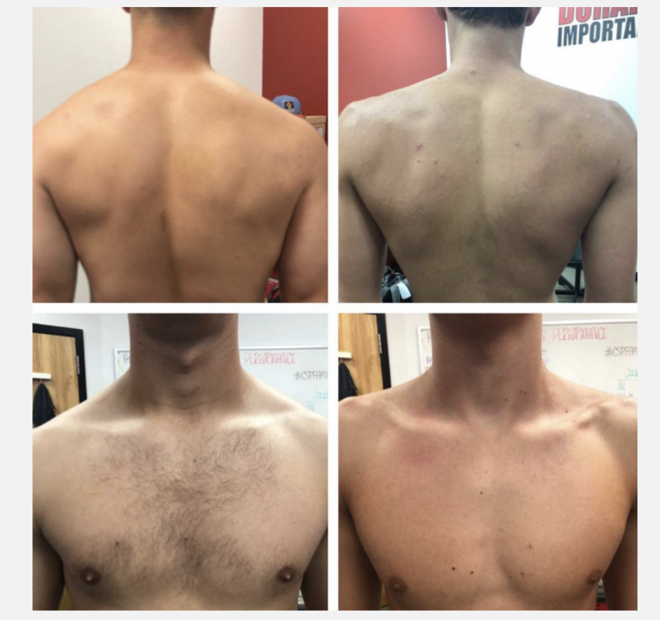 r these considered wide shoulders? | Looksmax - Men's Self-Improvement ...