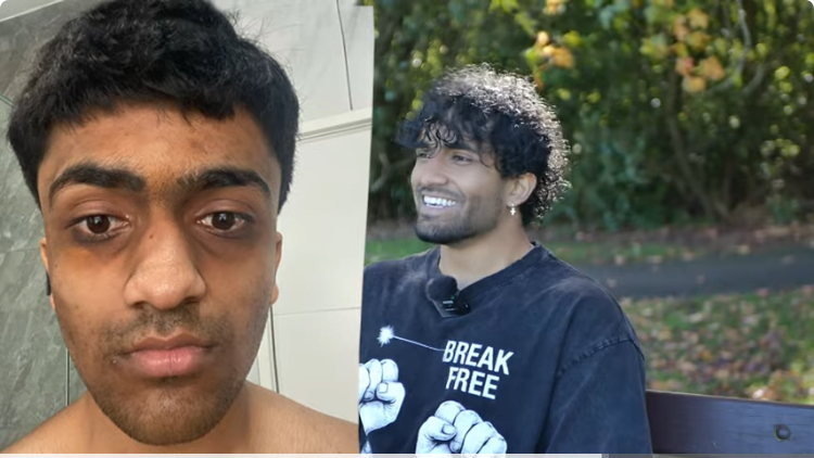 Craziest transformation I’ve ever seen. From subhuman curry who’d be ...