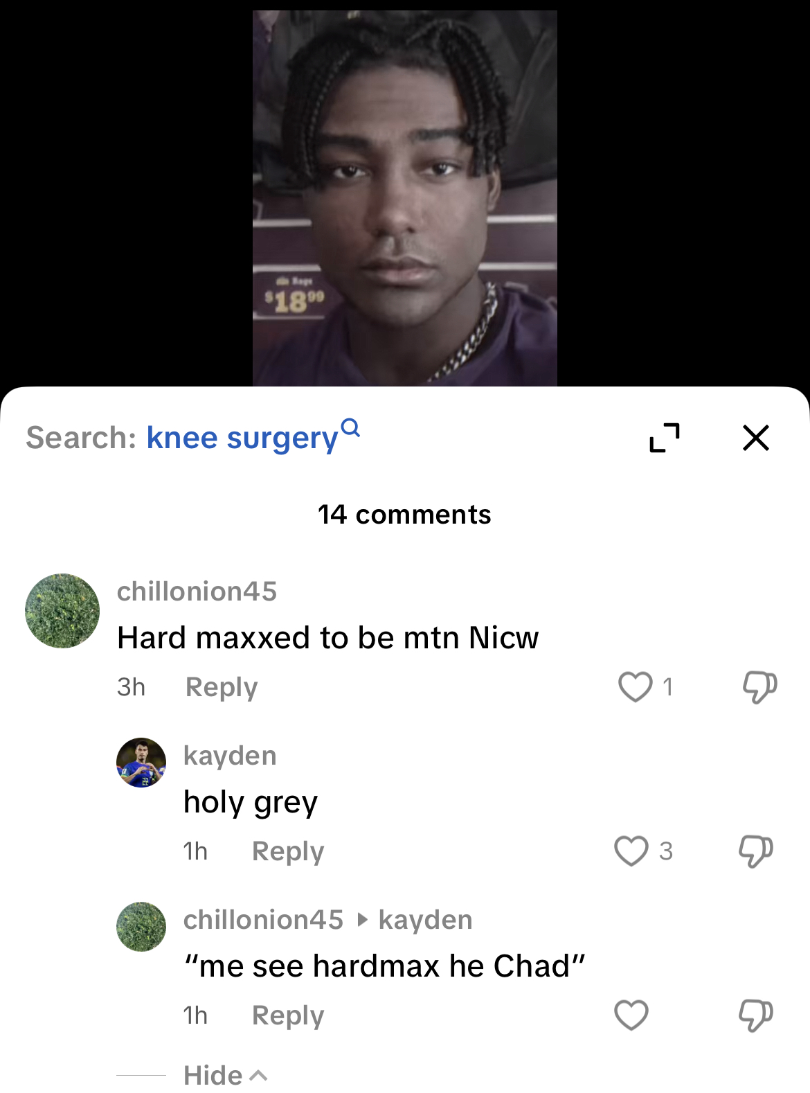 Holy grey | Looksmax.org - Men's Self-Improvement & Aesthetics