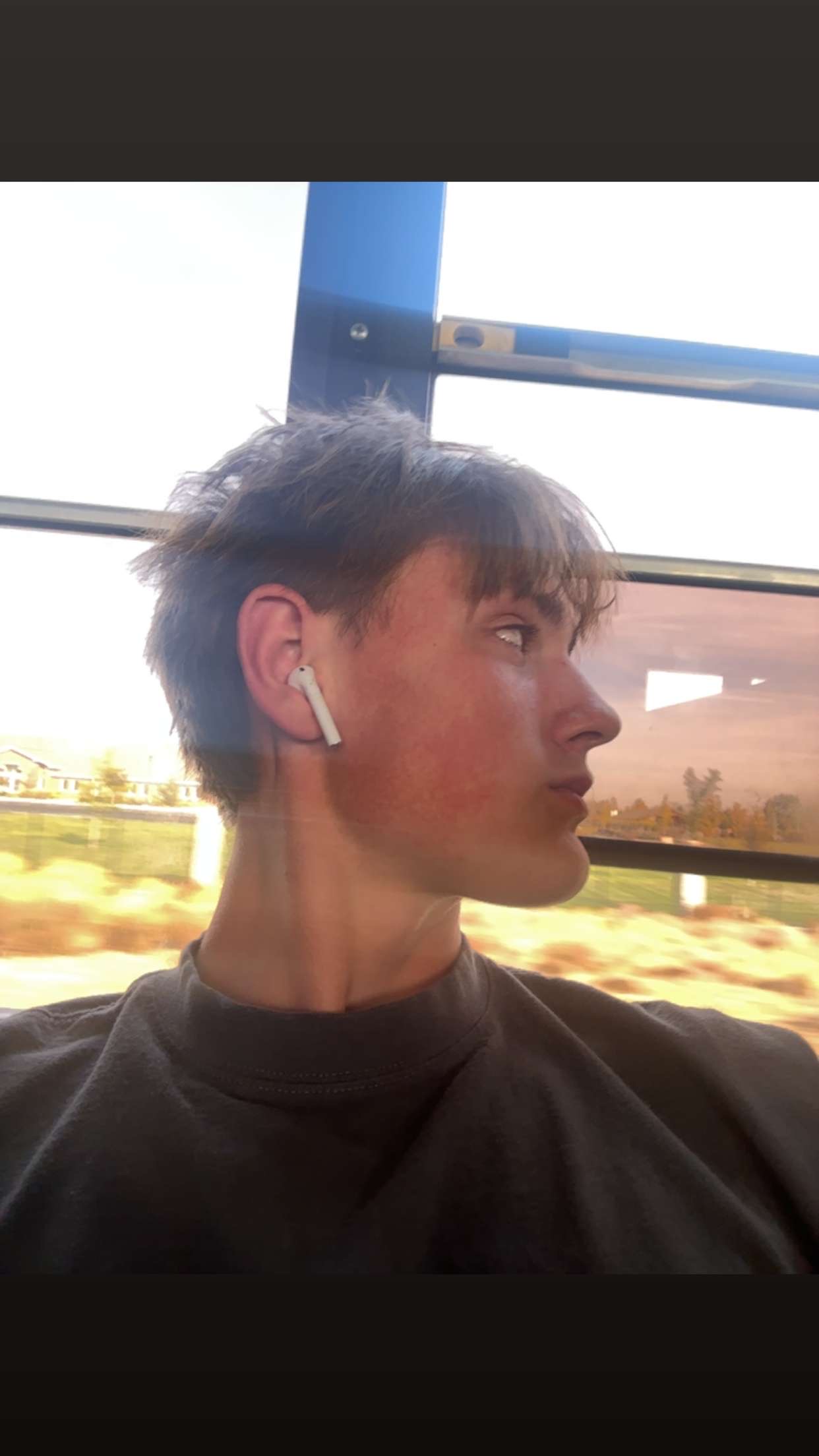 Rate my forward growth | Looksmax.org - Men's Self-Improvement & Aesthetics