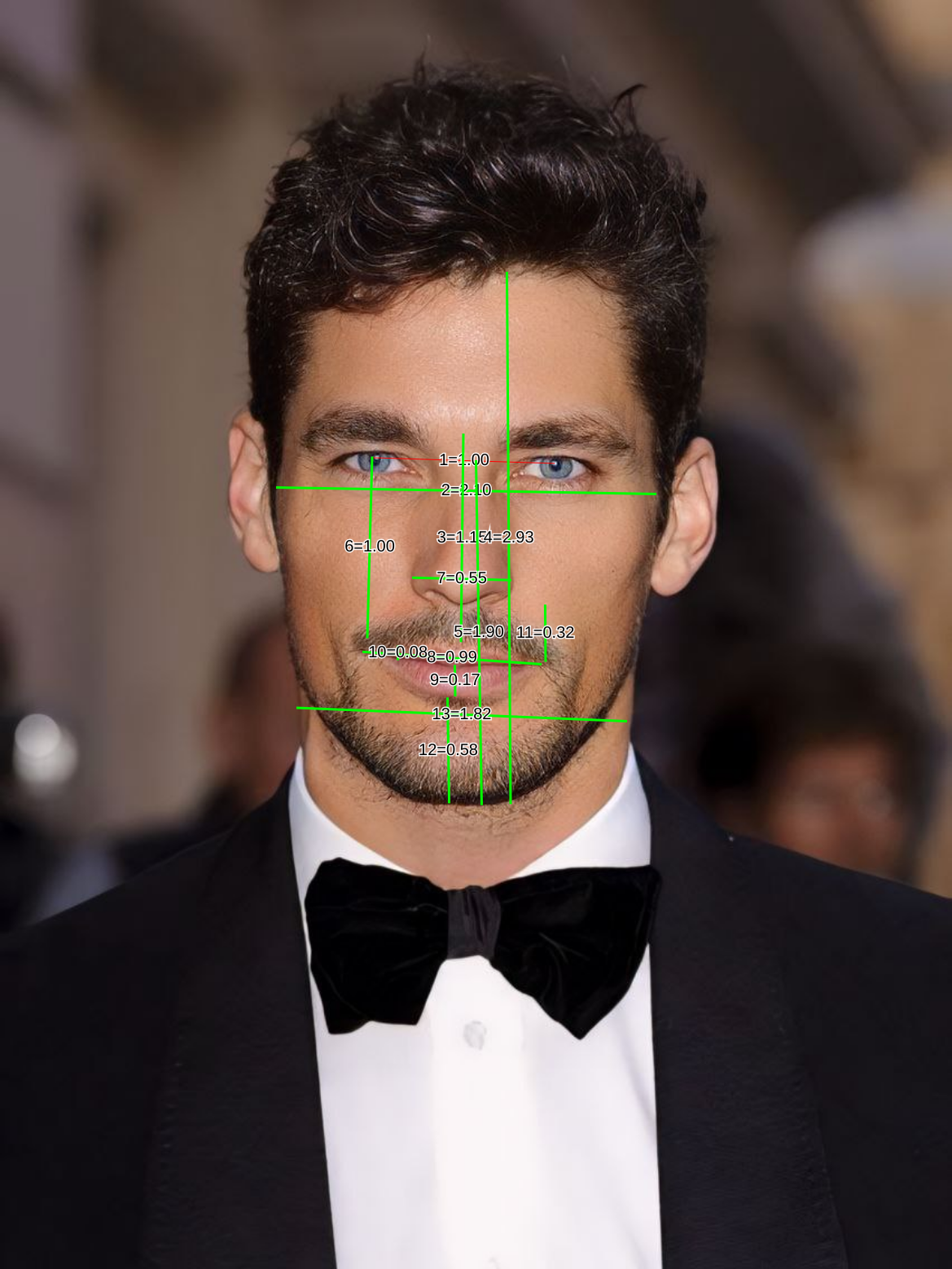 Midface Ratio Syndrome | Looksmax.org - Men's Self-Improvement & Aesthetics