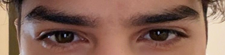 How do i improve my eye area? | Looksmax - Men's Self-Improvement ...