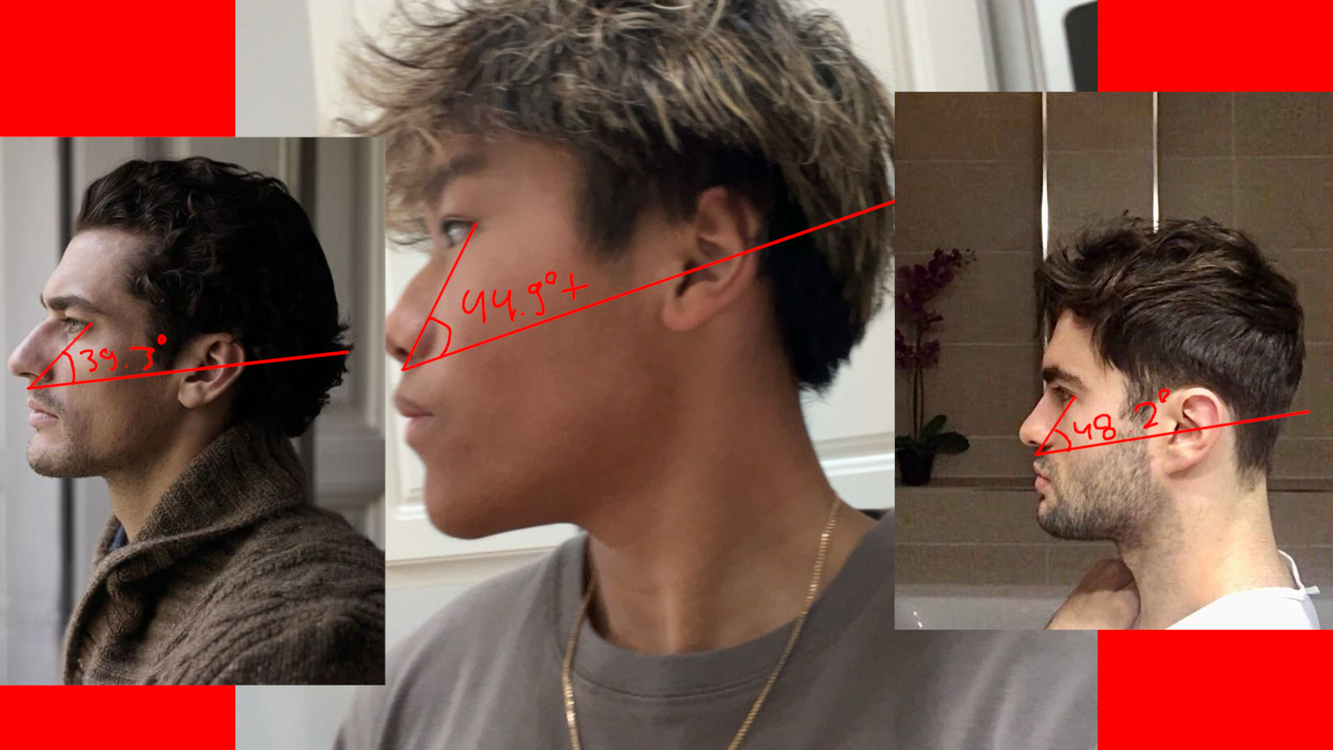 Is my maxilla recessed, and how bad is my underbite? | Looksmax.org ...