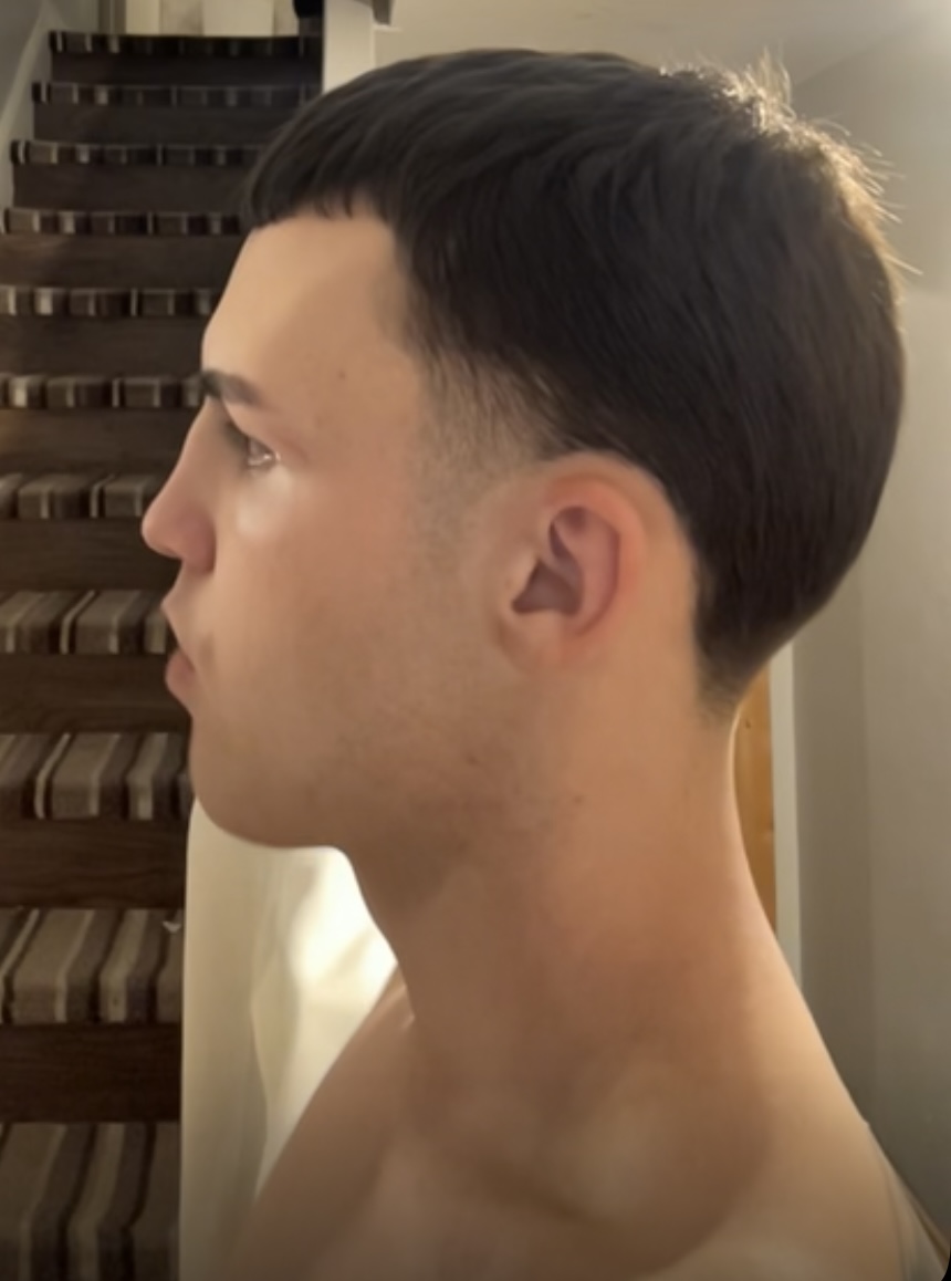 19 6’2 bone smashing progress | Looksmax.org - Men's Self-Improvement ...