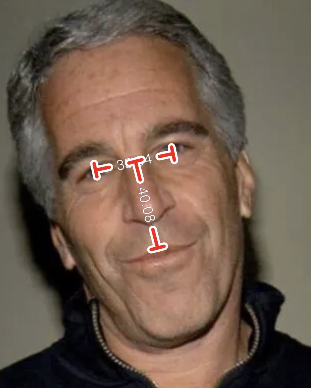 Jeffrey Epstein midface ratios | Looksmax.org - Men's Self-Improvement ...