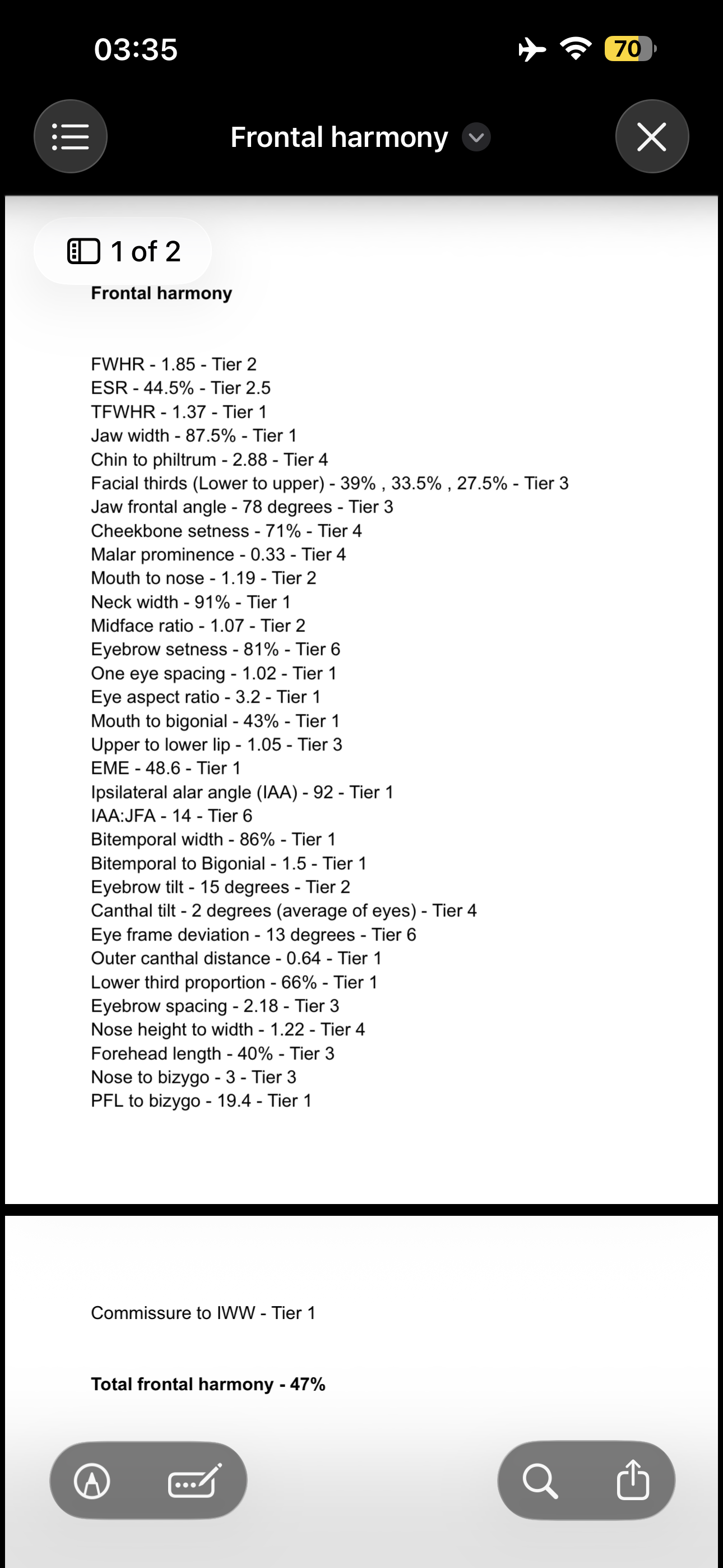 I have one of the best eyes area on org | Looksmax.org - Men's Self ...