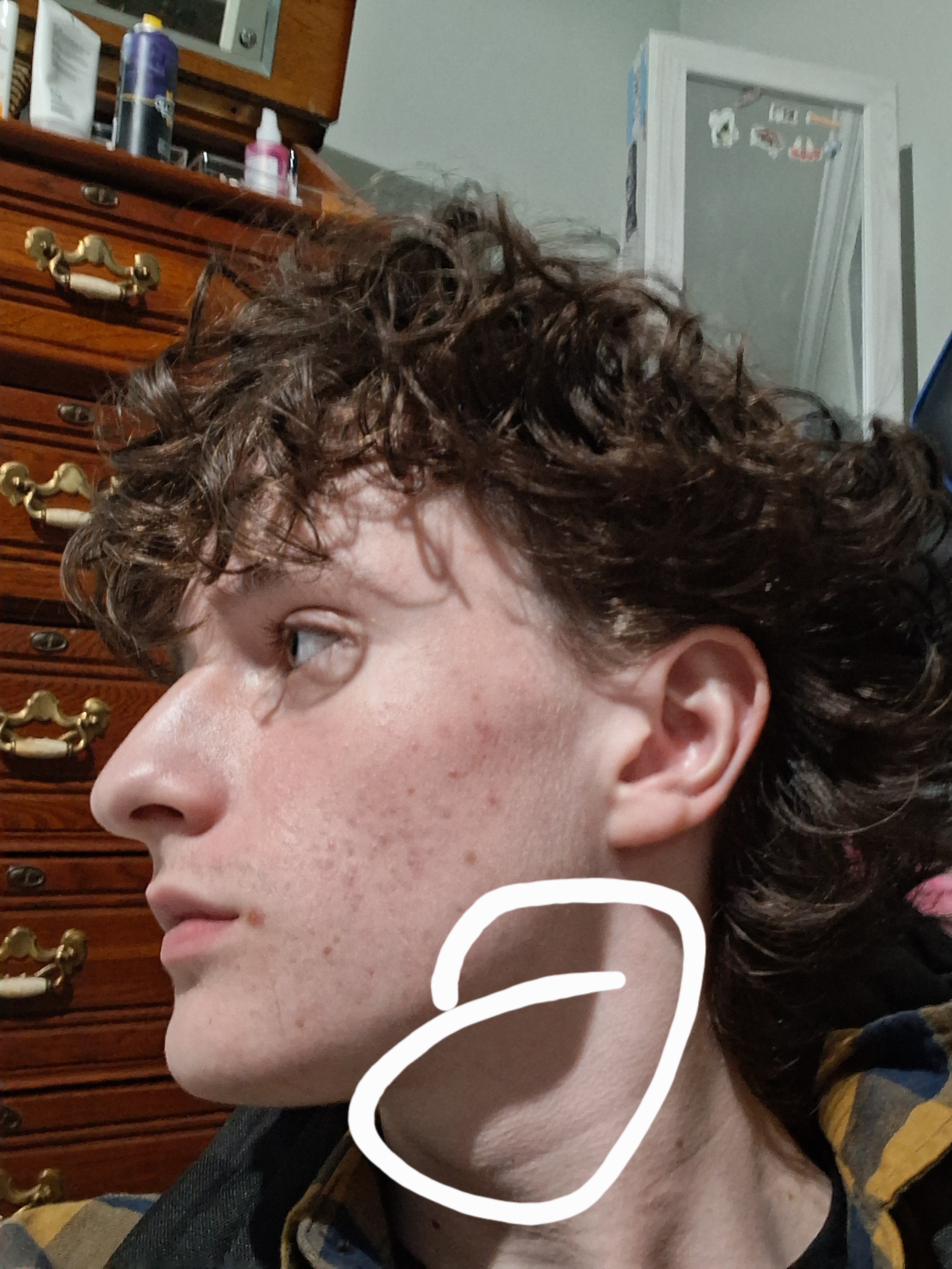 How do i get rid of this excess skin? Ive been mewing for years but i ...