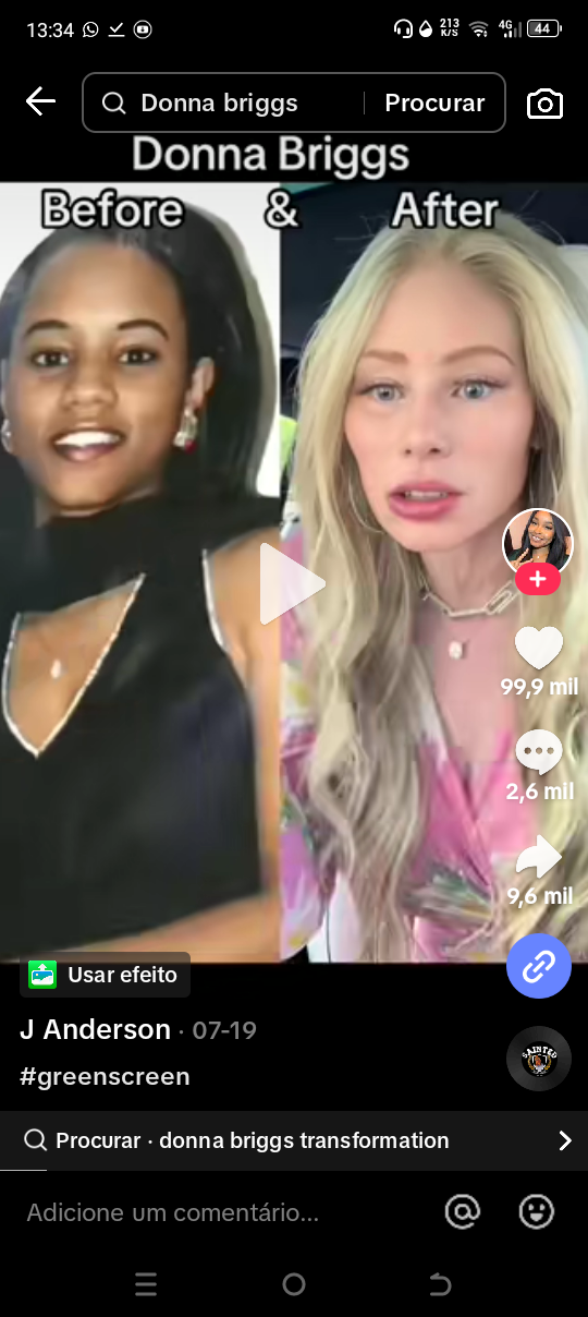 Being black and bleaching your skin is crazy, not even "just love ...