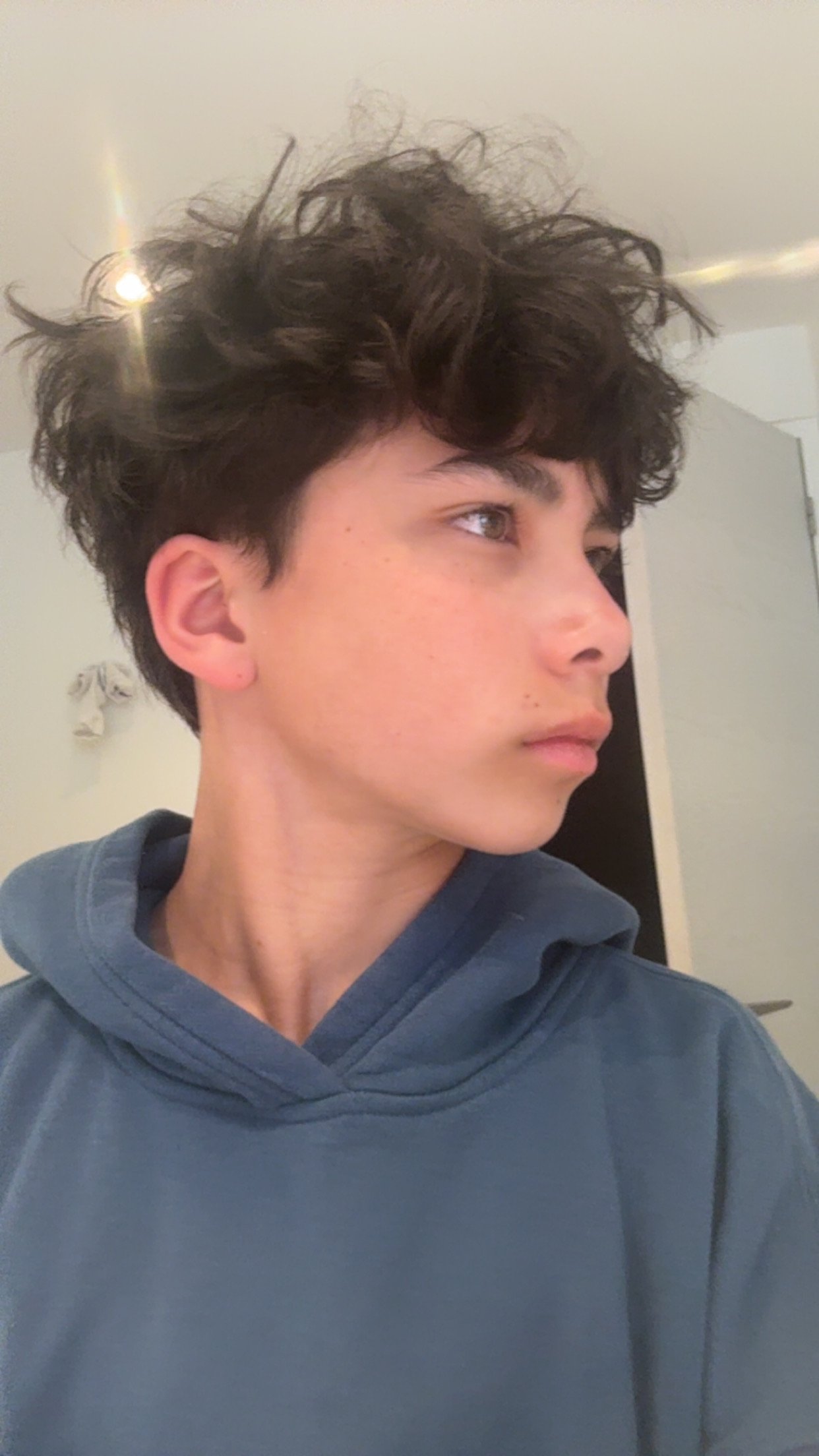 How do i fix my recessed mandible at 14M tanner stage 2-3 puberty ...