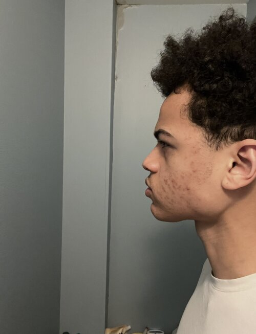 Rate my side profile ascension please | Looksmax.org - Men's Self ...