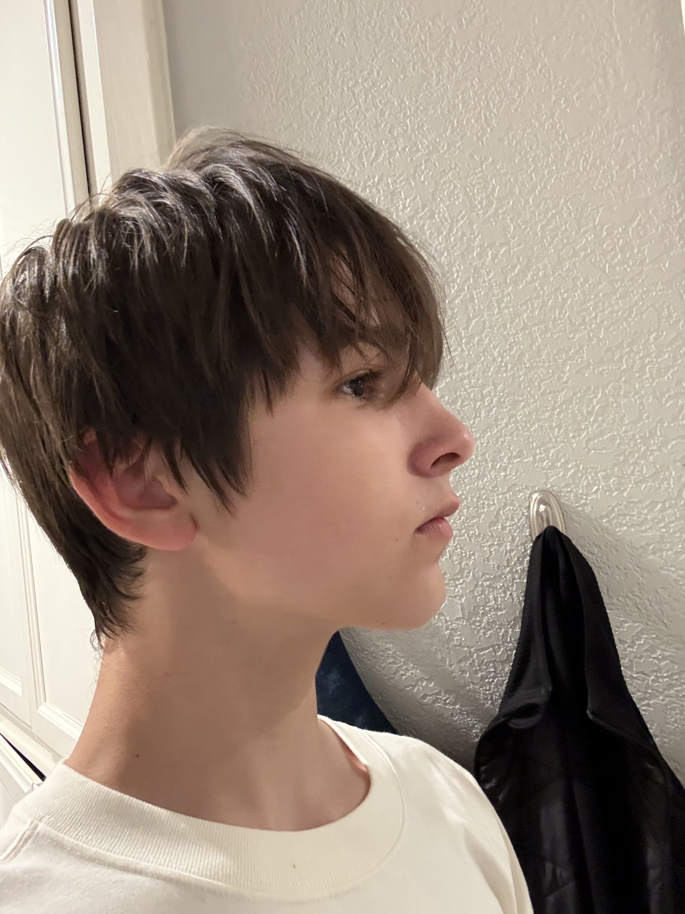 Is my maxilla and infras recessed? | Looksmax.org - Men's Self ...