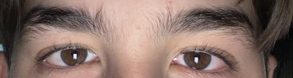 What to do to eye area am 14 | Looksmax.org - Men's Self-Improvement ...