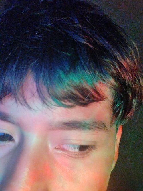 Why is there a extra crease on my left eyelid and not my right ...
